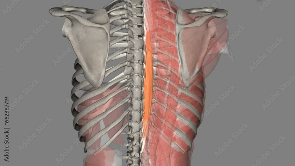 Spinalis Thoracis belongs to the medial column of the erector spinae ...