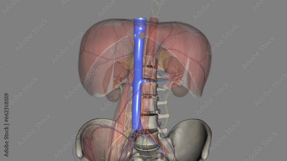 The inferior vena cava (IVC) is a large retroperitoneal vessel formed ...