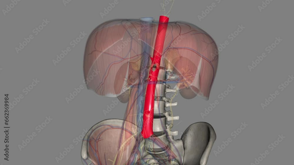 An abdominal aortic aneurysm is an enlarged area in the lower part of ...