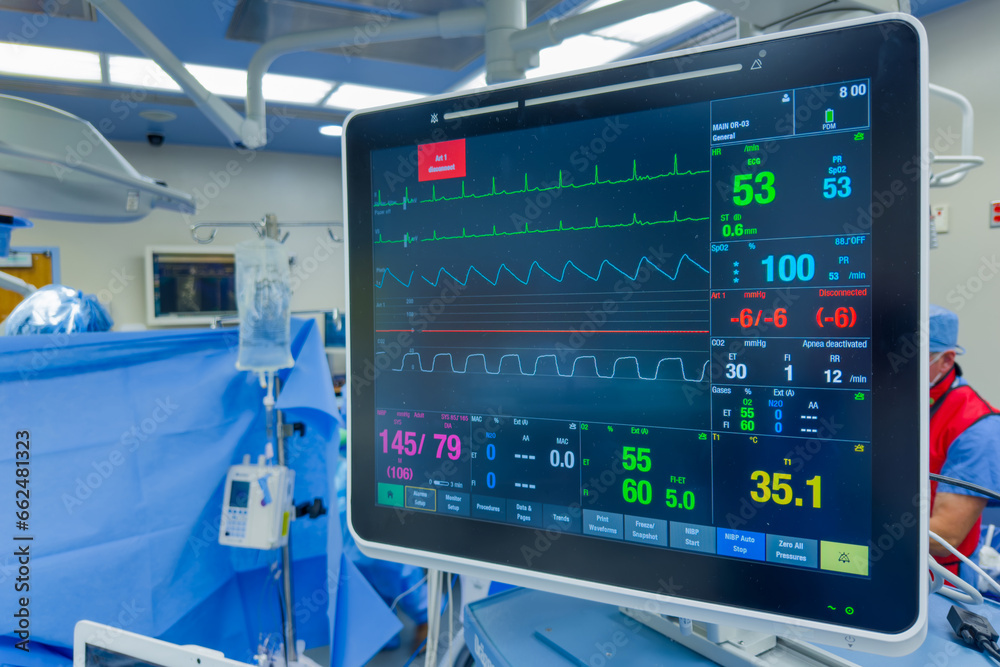 hospital monitor displaying vital signs: heart rate, blood pressure ...