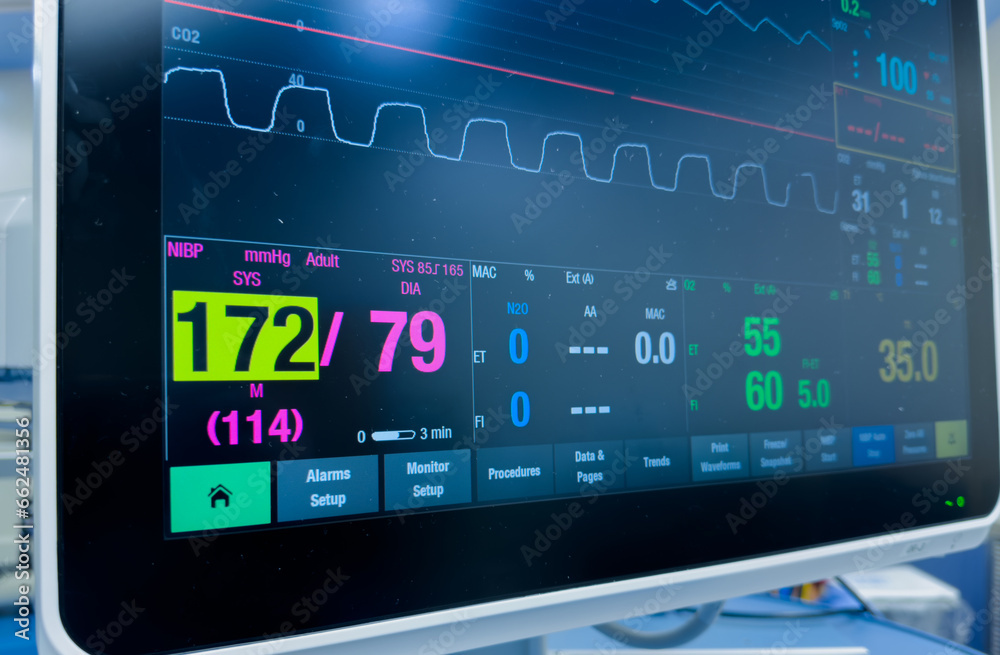 hospital monitor displaying vital signs: heart rate, blood pressure ...