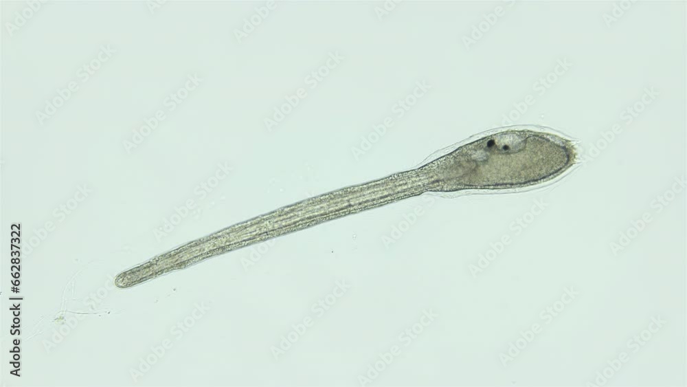 Larva of sea squirts Halocynthia pyriformis under microscope, class ...