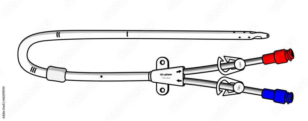 Cuffed catheter with symmetric-tip for hemodialysis Stock Vector ...