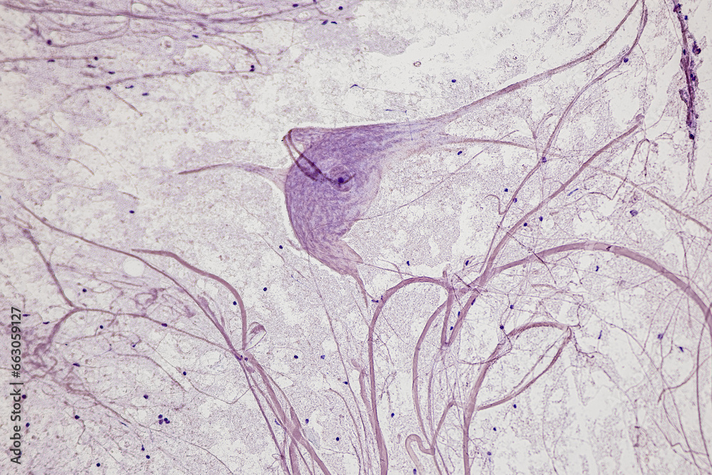 Motor Neuron, Spinal cord, Nerve fibres and nerve cells under the ...