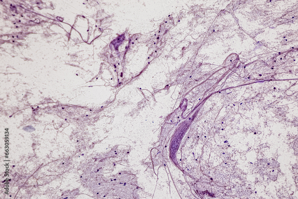 Motor Neuron, Spinal cord, Nerve fibres and nerve cells under the ...