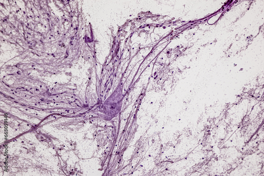 Motor Neuron, Spinal cord, Nerve fibres and nerve cells under the ...