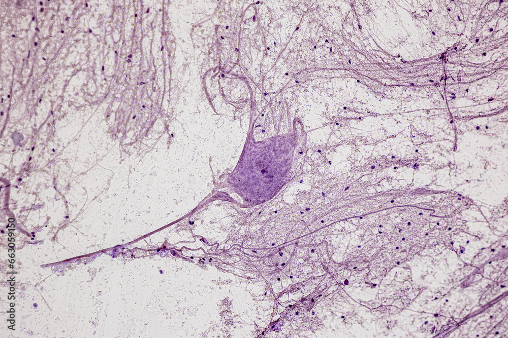 Motor Neuron, Spinal cord, Nerve fibres and nerve cells under the ...