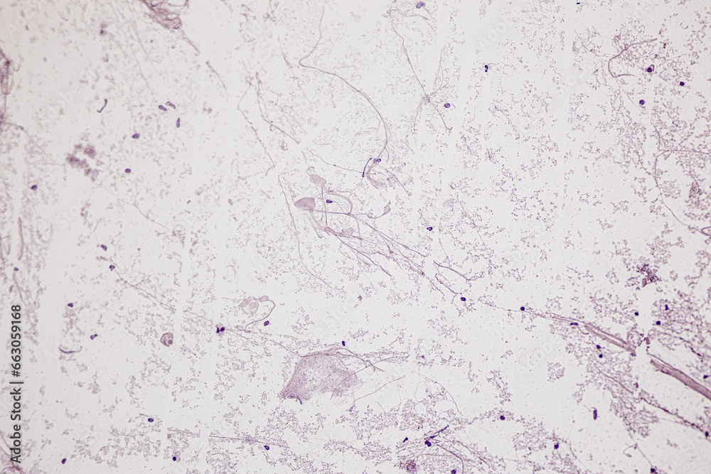 Motor Neuron, Spinal cord, Nerve fibres and nerve cells under the ...