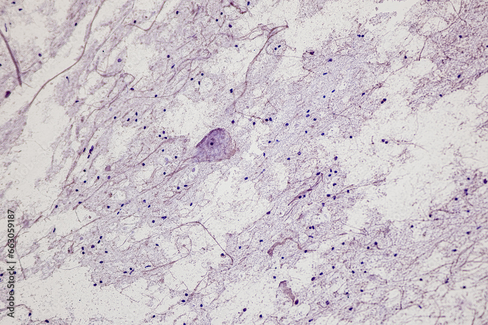 Motor Neuron, Spinal cord, Nerve fibres and nerve cells under the ...