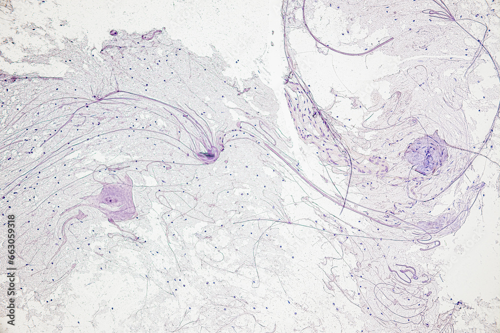 Motor Neuron, Spinal cord, Nerve fibres and nerve cells under the ...