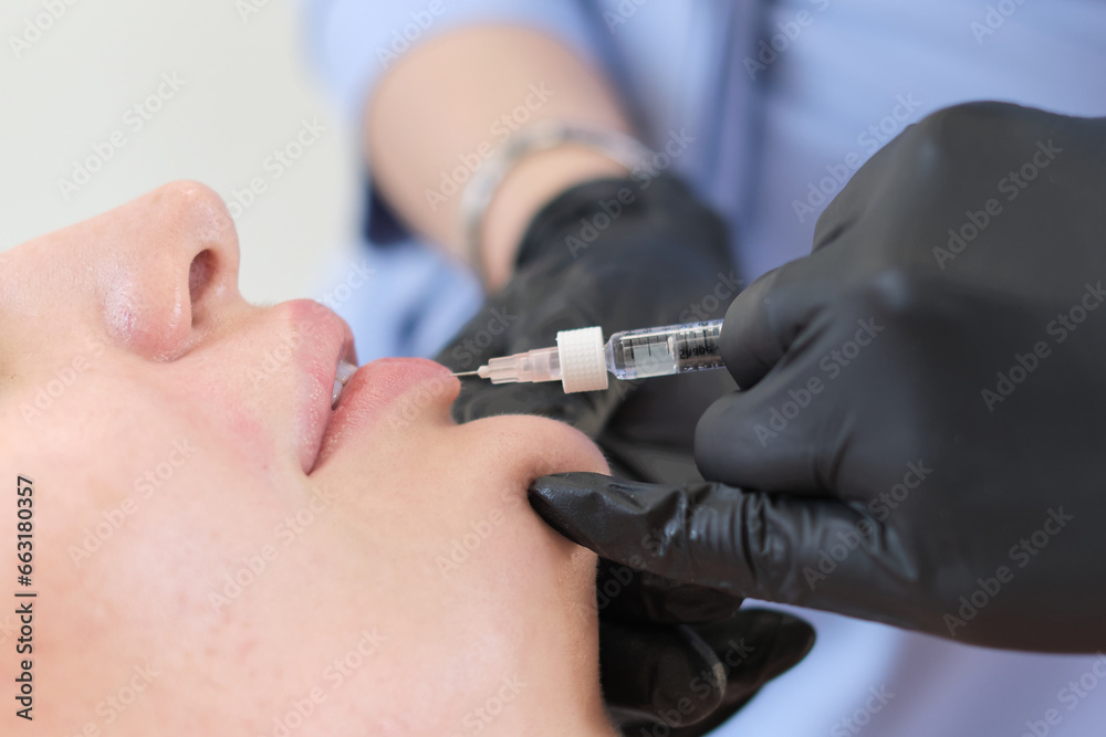 The moment of transformation: a lip filler procedure. Where desire for ...