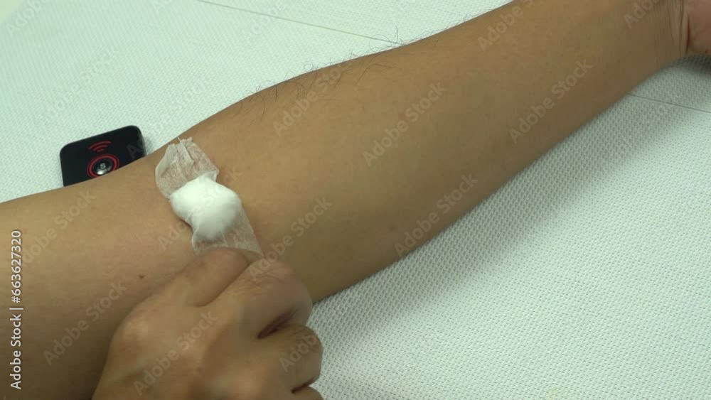 Vidéo Stock Close up a hand was peeling off the wound dressing on the ...