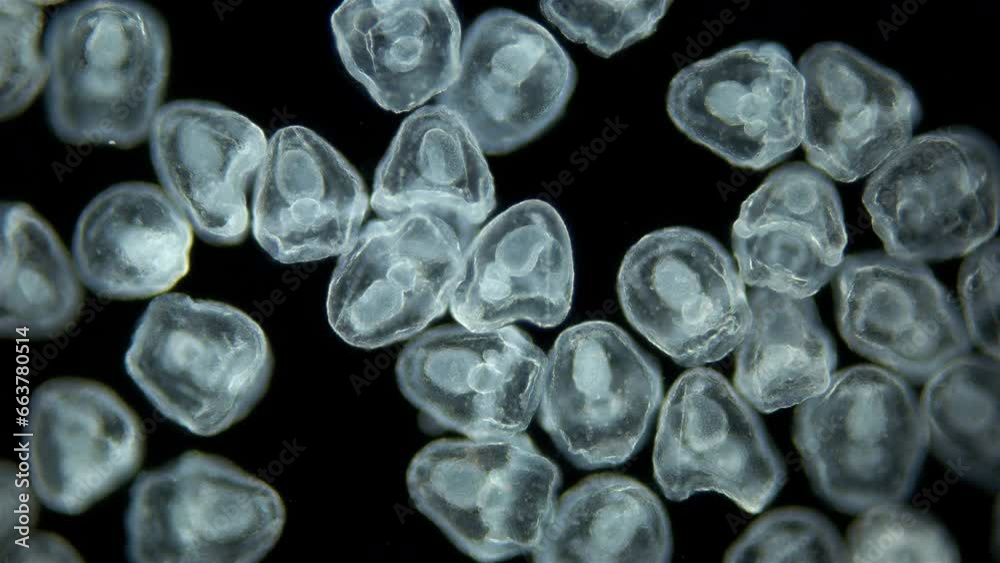 Larvae sea urchin Strongylocentrotus pallidus under microscope, phylum ...