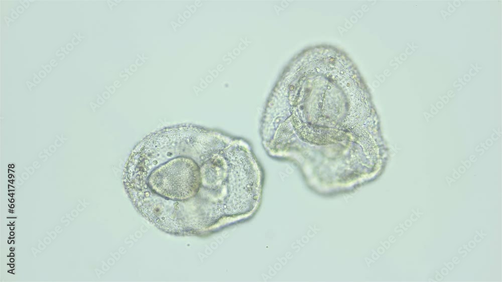 Larvae sea urchin Strongylocentrotus pallidus under microscope, phylum ...