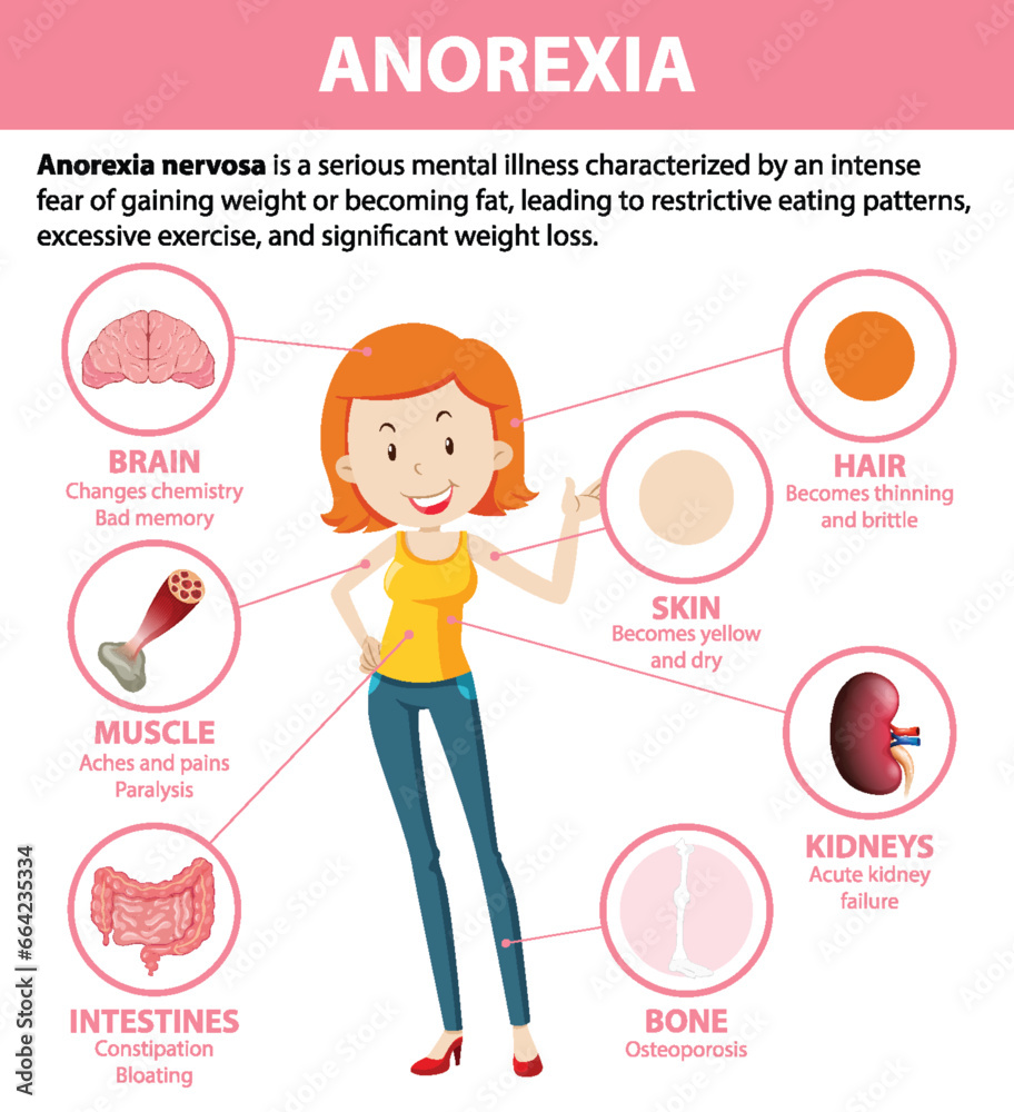 Unhealthy Female Anatomy: Anorexia's Effects on Body Functions Stock ...