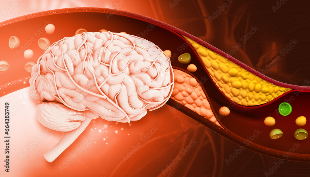 Human brain anatomy on Clogged arteries background. 3d illustration ...