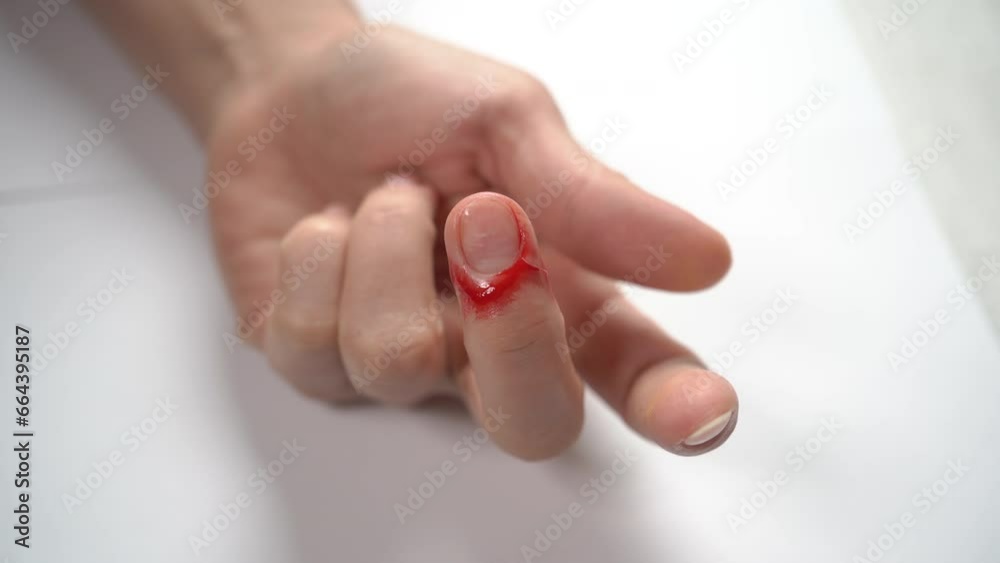 A hand with blood, a cut on a finger with a sharp object, blood oozing ...