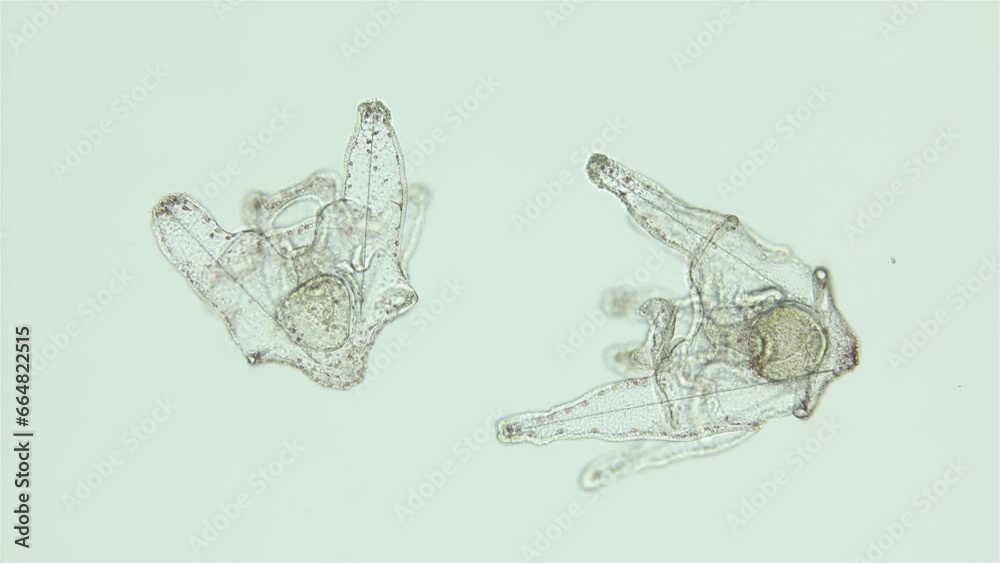 Larvae sea urchin Strongylocentrotus pallidus under microscope, phylum ...