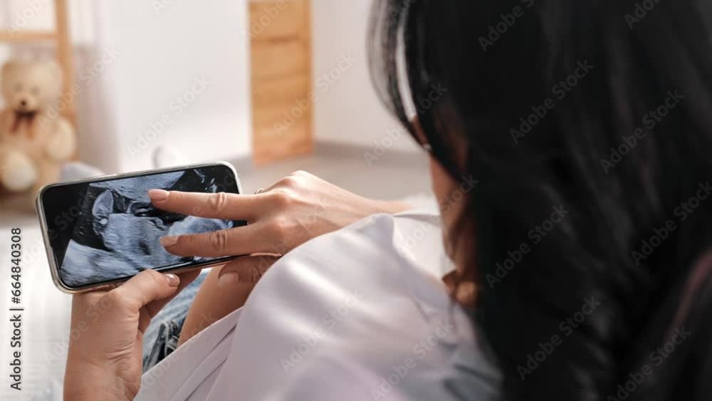 Pregnant woman with belly looking digital x ray baby roentgen scan ...