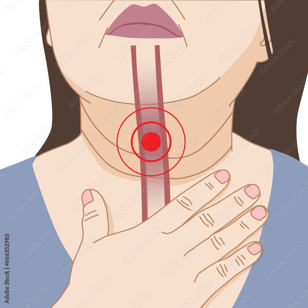 Elderly woman difficulty swallowing, dysphagia, unhealth, illustration ...