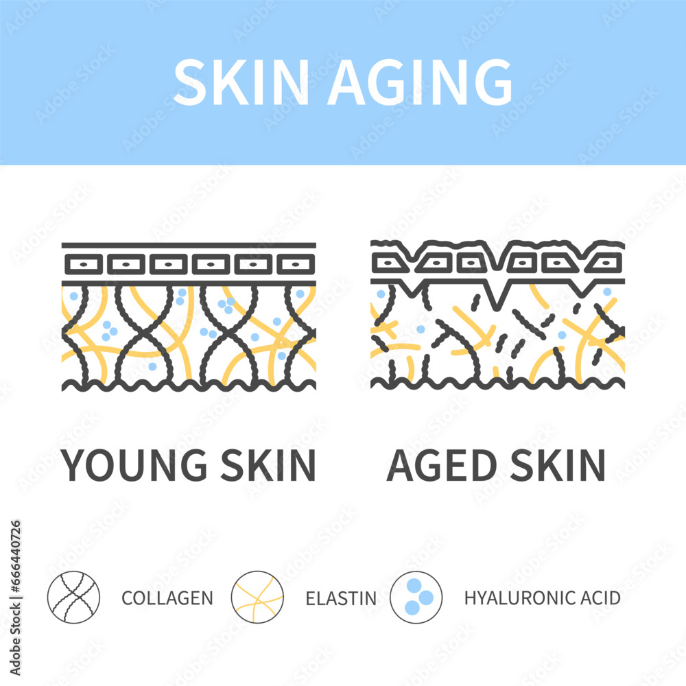 Vetor de Young skin versus aged skin cross section diagram. Firm skin ...