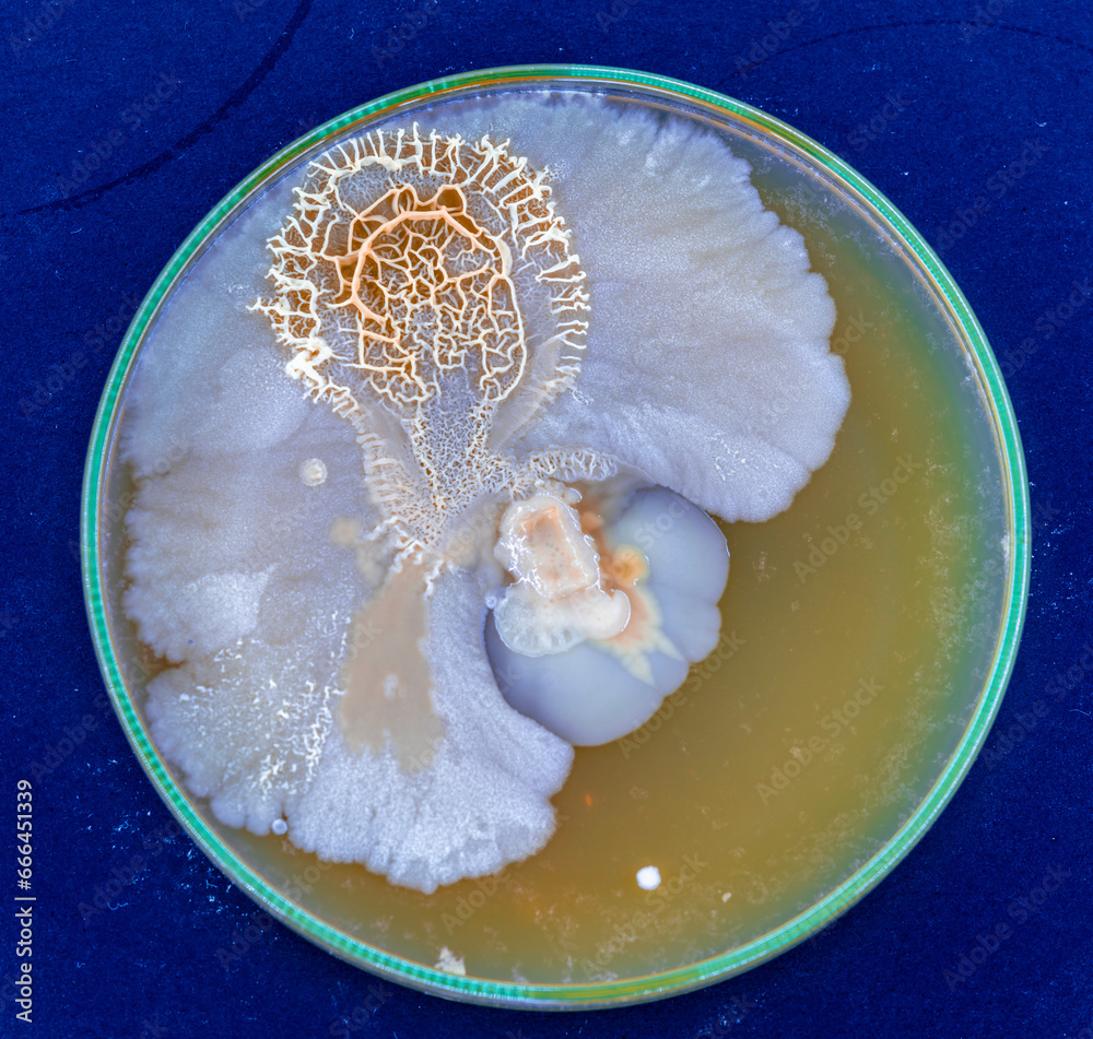 colonies of bacteria and microorganisms on the surface of agar and wind ...