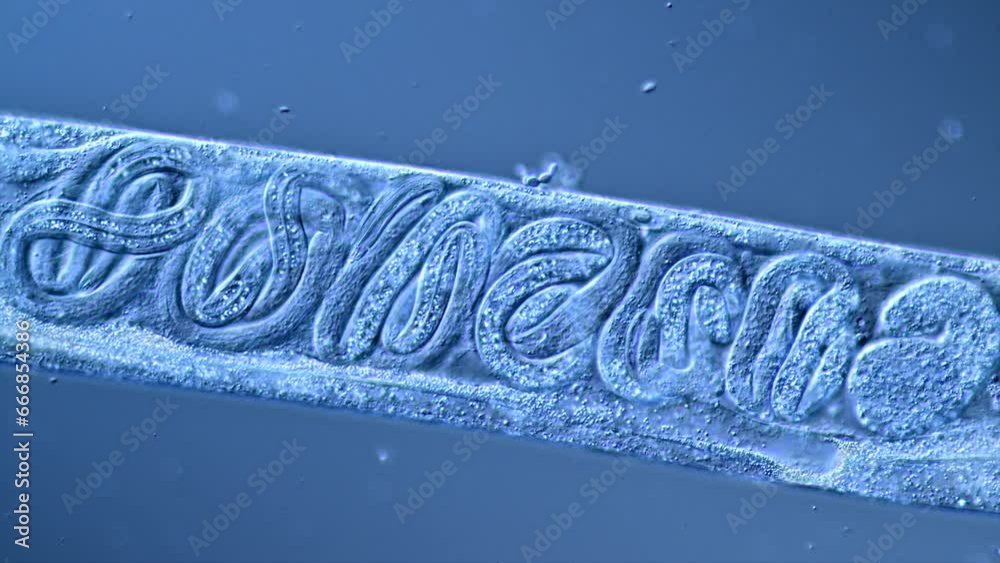 Vidéo Stock Close up of Vinegar eel nematode mother worm revealing ...