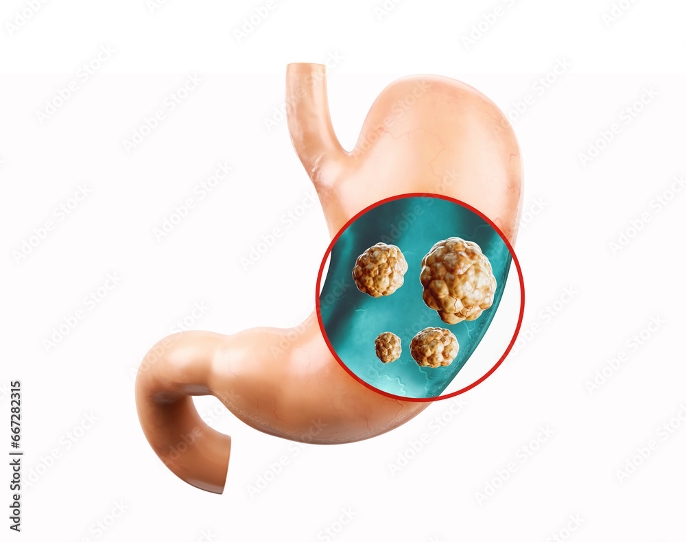 Anatomy of realistic 3d illustration of human internal organ - stomach ...