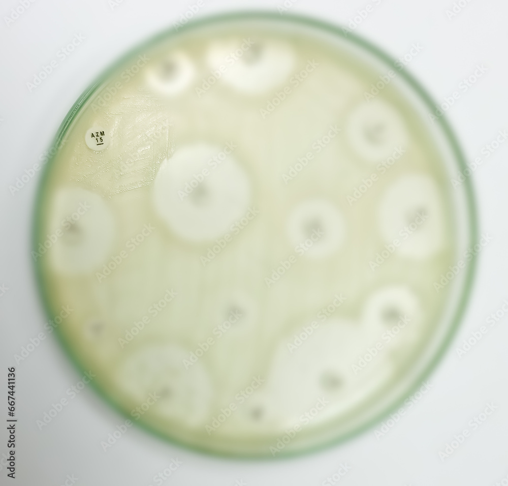 Antimicrobial susceptibility testing in culture plate. Drug sensitivity ...