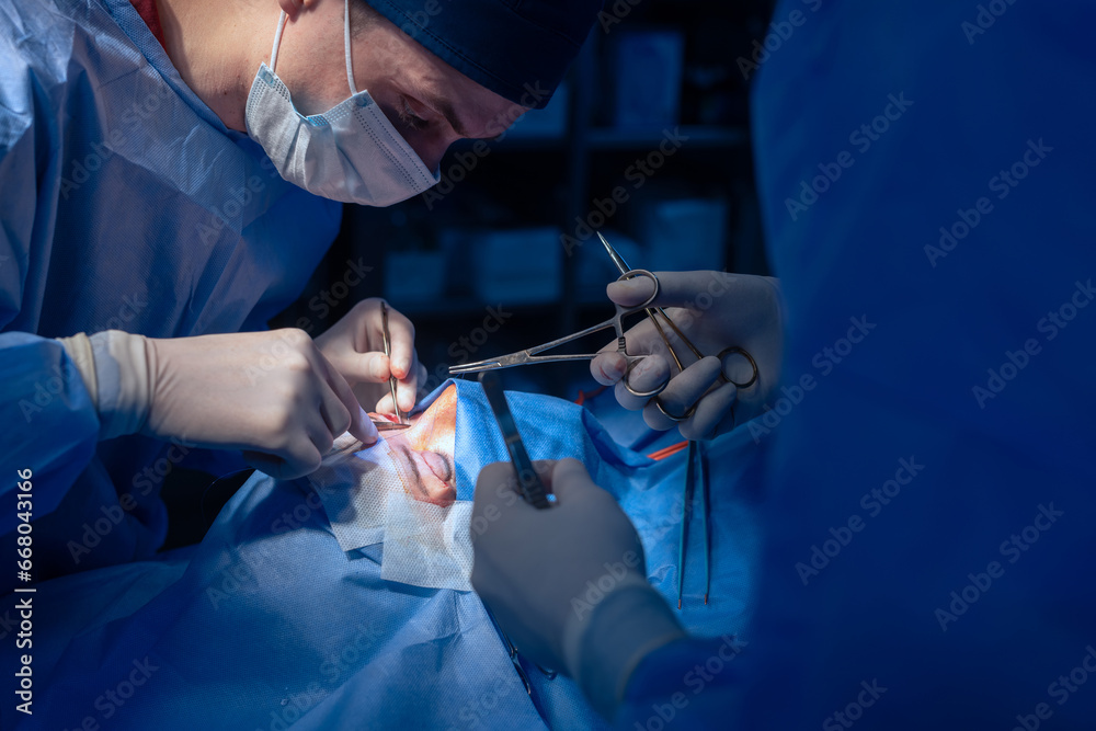 Blepharoplasty, plastic surgery operation for correcting defects ...