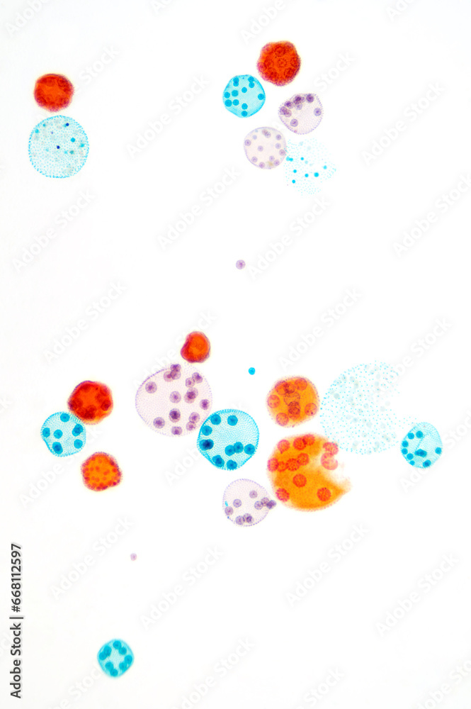 Volvox, green algae, whole mount, 8X light micrograph. Polyphyletic ...