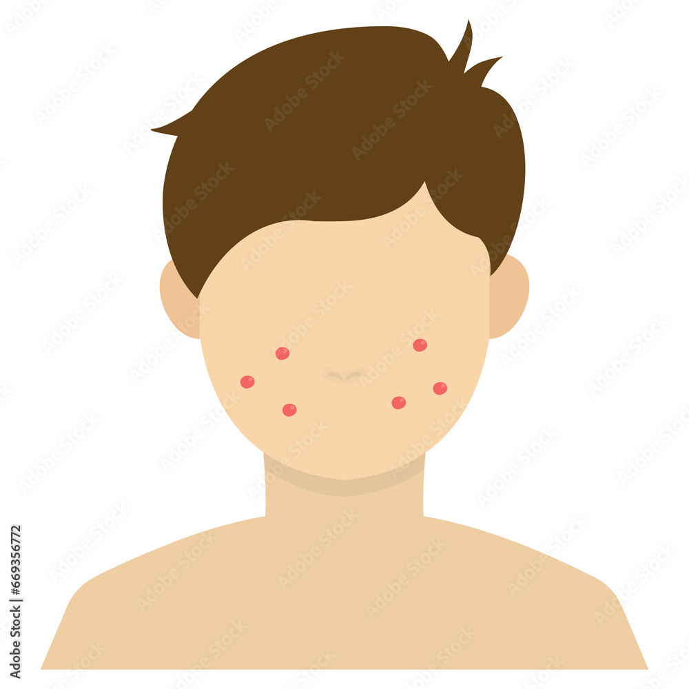 Vector illustration of pimple icon sign and symbol. colored man icons ...
