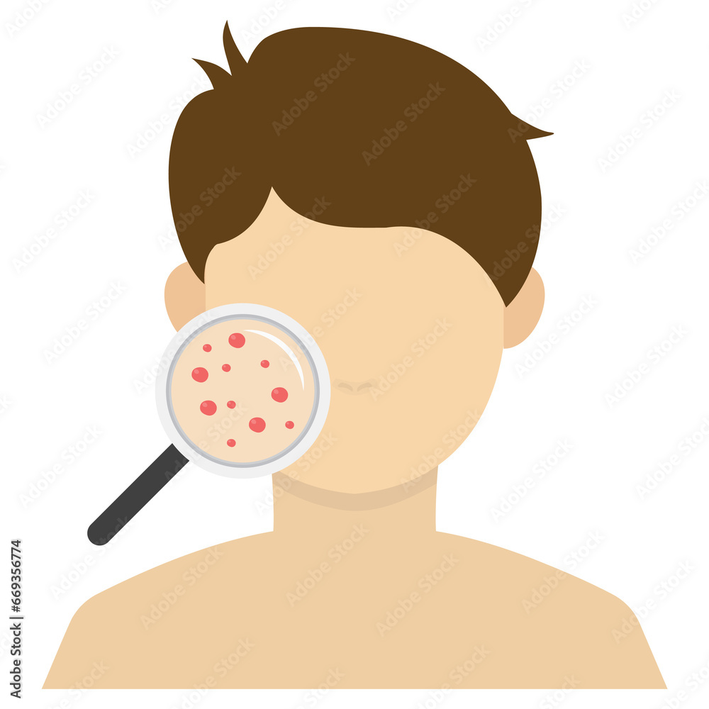 Vector illustration of look at pimples with a magnifying glass icon ...