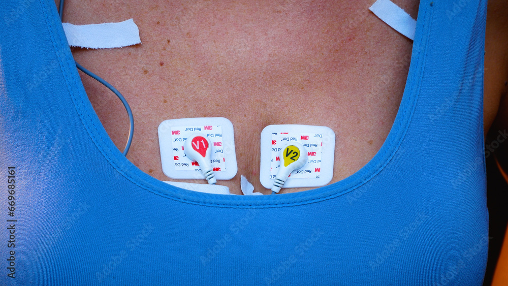Unrecognizable woman with a device for daily monitoring of heart ...