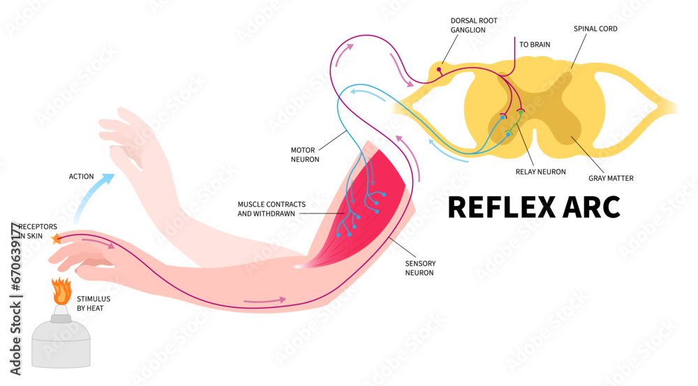 Hand arm reflex action with motor neuron cell disease in human the ...