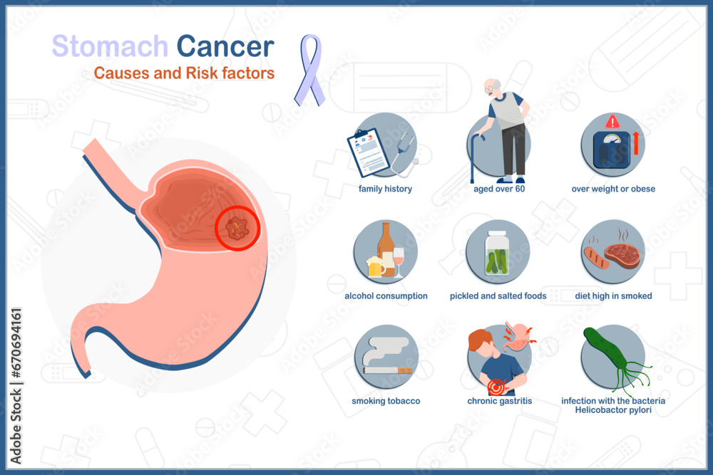 Medical Concepts of causes and risk factors of stomach cancer.Obesity ...