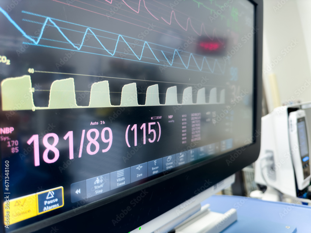hospital monitor displaying vital signs: blood pressure, heart rate ...