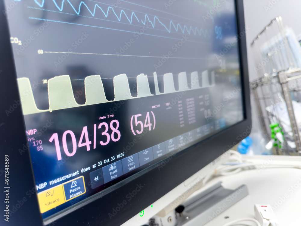hospital monitor displaying vital signs: blood pressure, heart rate ...