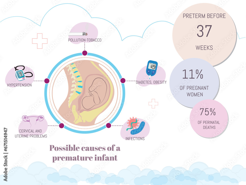 Possible causes of premature pregnancy. Circular diagram with the 5 ...