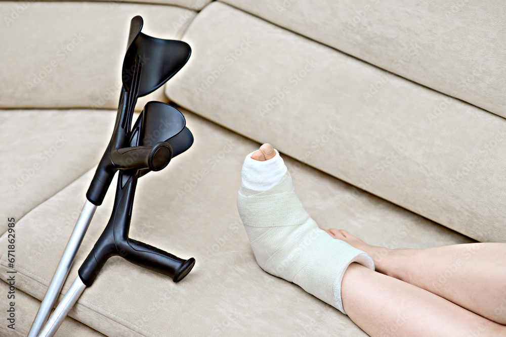 Female broken leg in a plaster cast next to a crutches still keeping ...