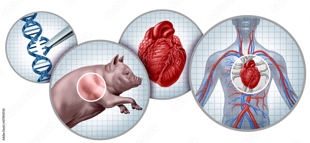 Pig donor To Human Heart Transplant concept as a genetically modified ...