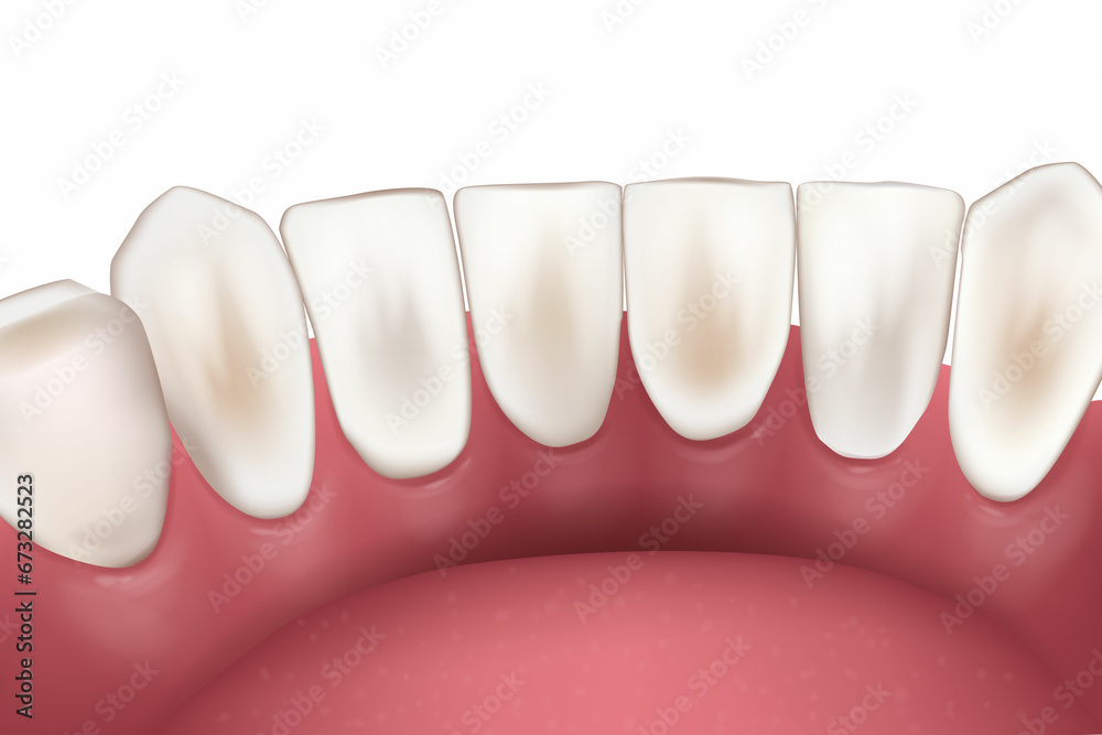 Realistic lower incisors teeth. 3d render of lower jaw. Dental anatomy ...