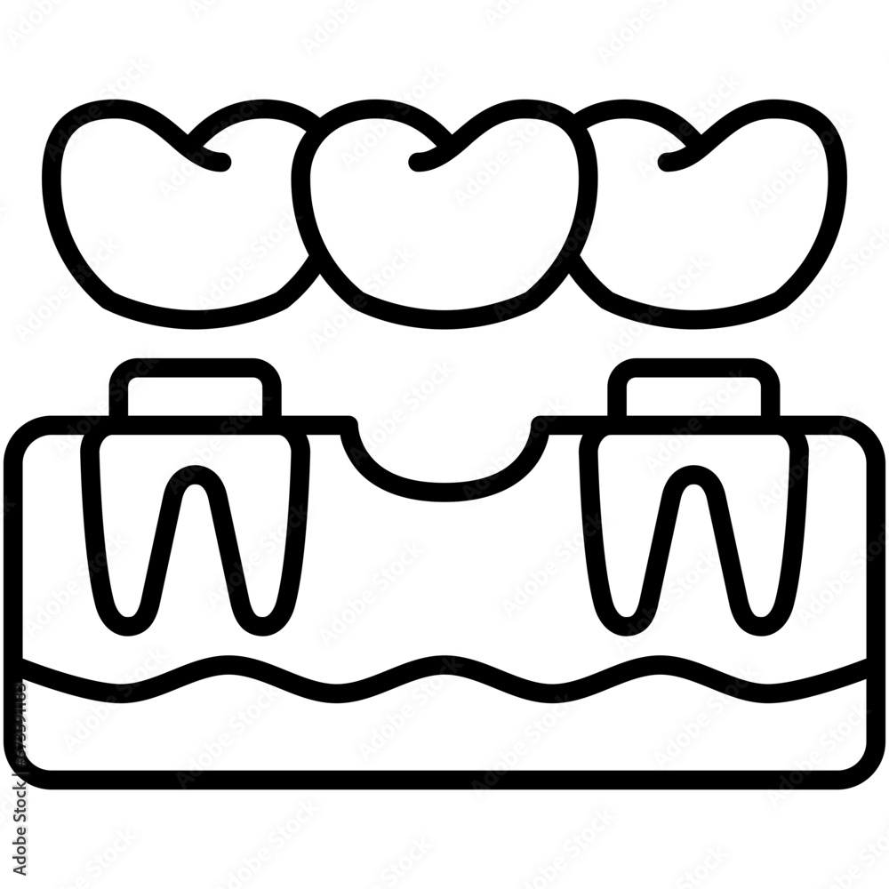 Dental Bridge Icon. Prosthesis Tooth Surgery Symbol Stock Illustration ...
