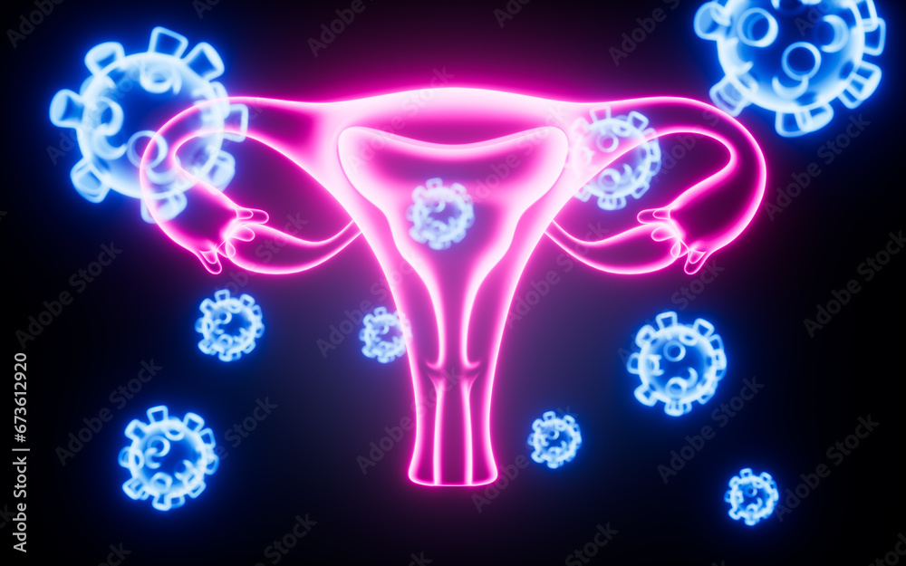 Virus attack uterus, hpv infection, female reproductive system, 3d ...
