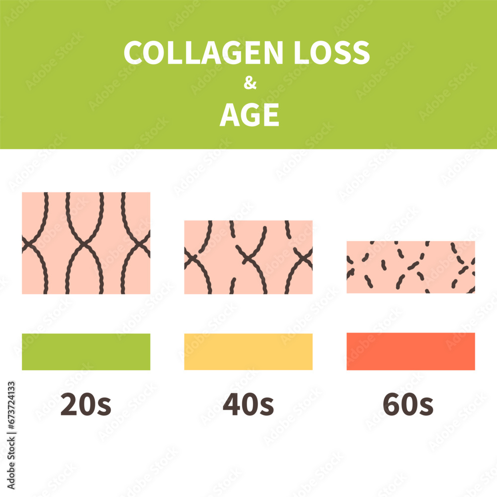 Collagen peptide protein loss process illustration. Cell structure in ...