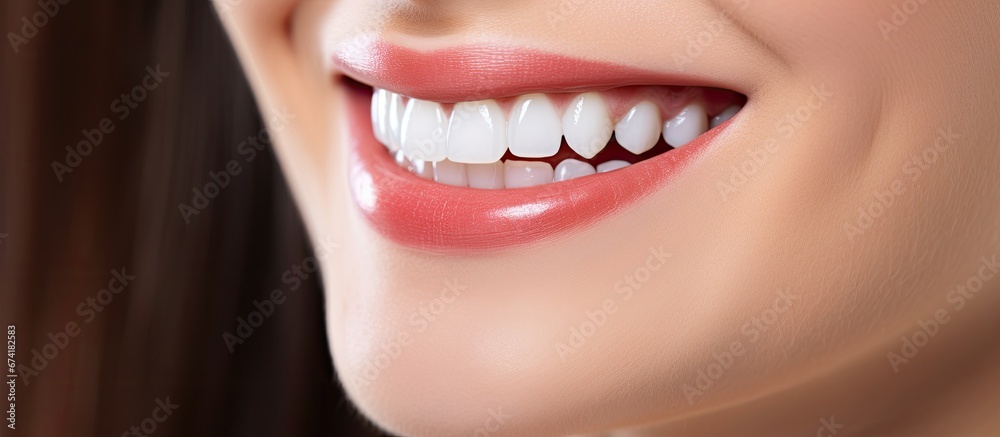 A young girl with a charming smile and new front teeth that are growing ...