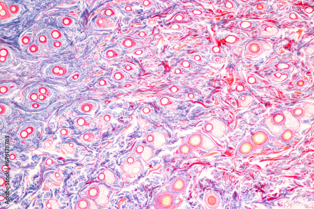 Characteristics Tissue of Human scalp, Skin human from general body ...