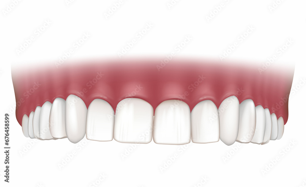 Realistic correct human upper jaw. Human jaw isolated on white ...