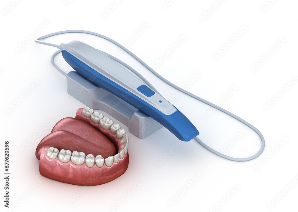 Intraoral Teeth 3D scanner. My own design. Dental 3D illustration ...