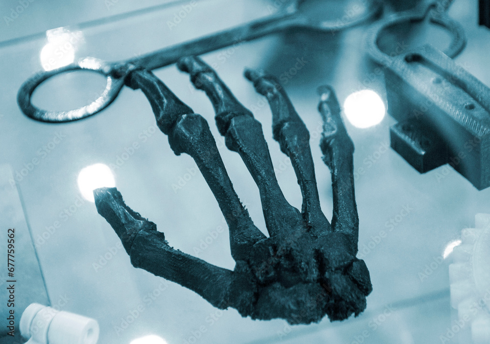 Prototype model of part of human skeleton wrist hand printed on 3D ...